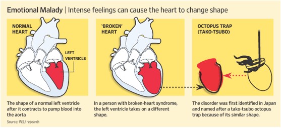 The 'broken heart syndrome' is REAL