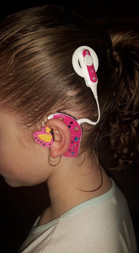 This creative mom transforms kids' hearing aids into superheroes to ...