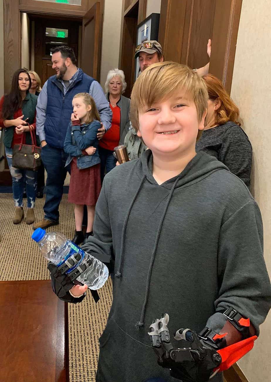 Boy born without fingers calls his new 3D-printed hands 'a miracle come ...