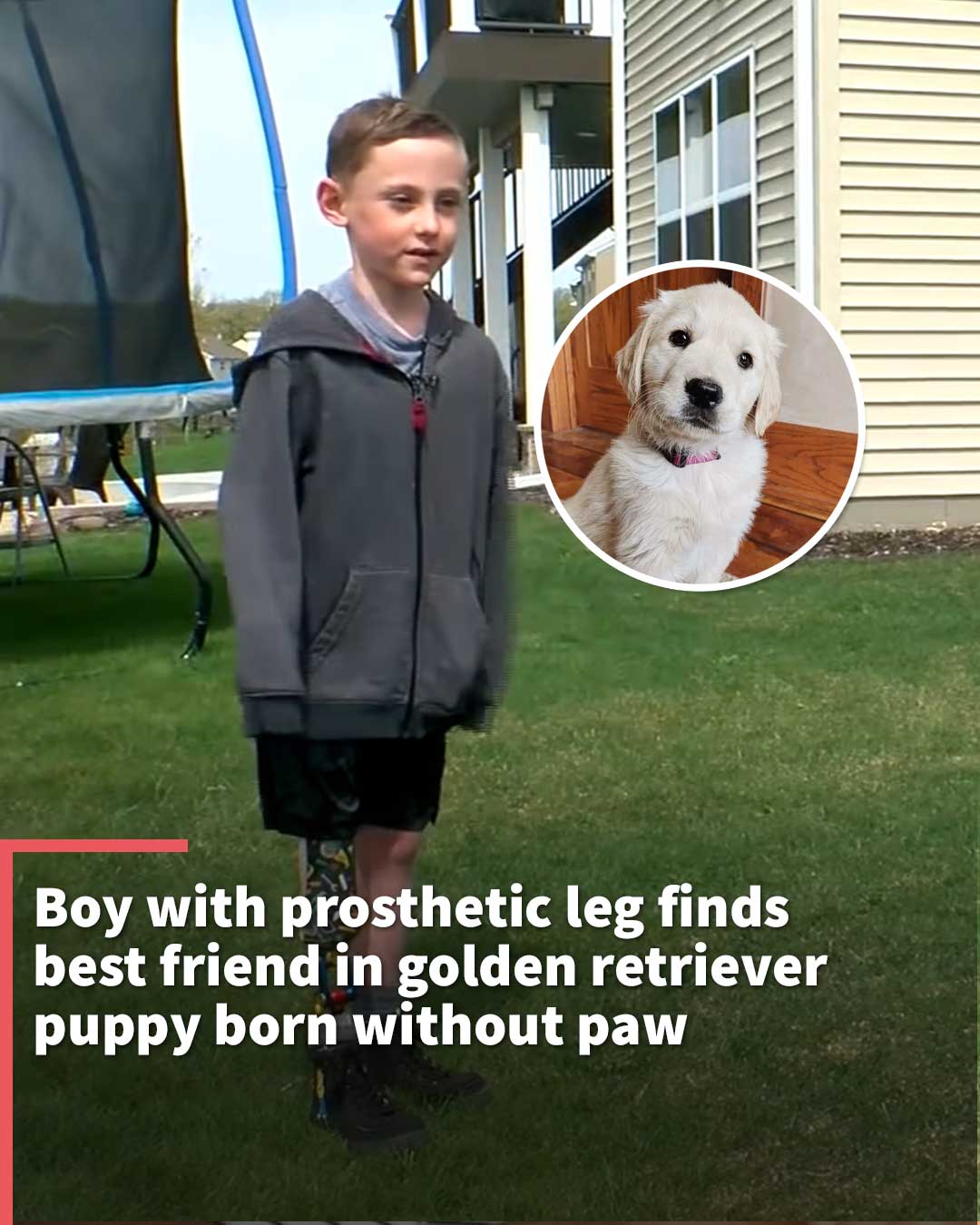 Boy with prosthetic leg adopts pup without paw