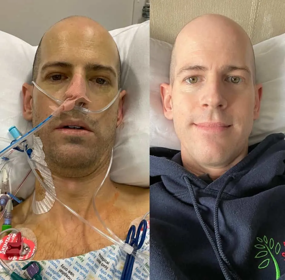 Man shares dramatic pre and post liver transplant surgery to prove that ...