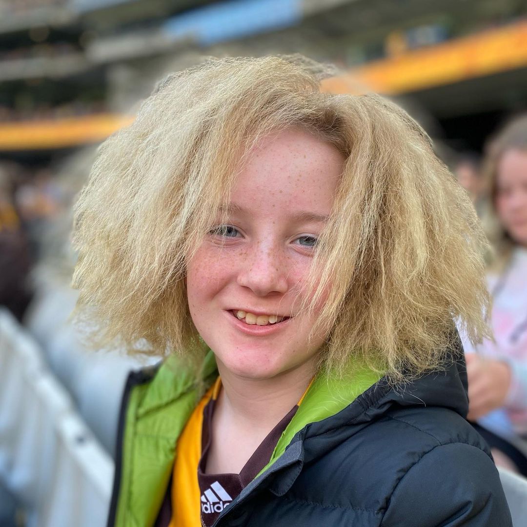 Young girl learns to love her uncombable hair syndrome