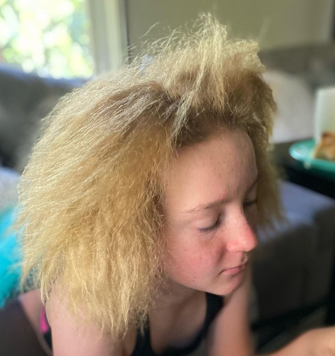 Young girl learns to love her uncombable hair syndrome