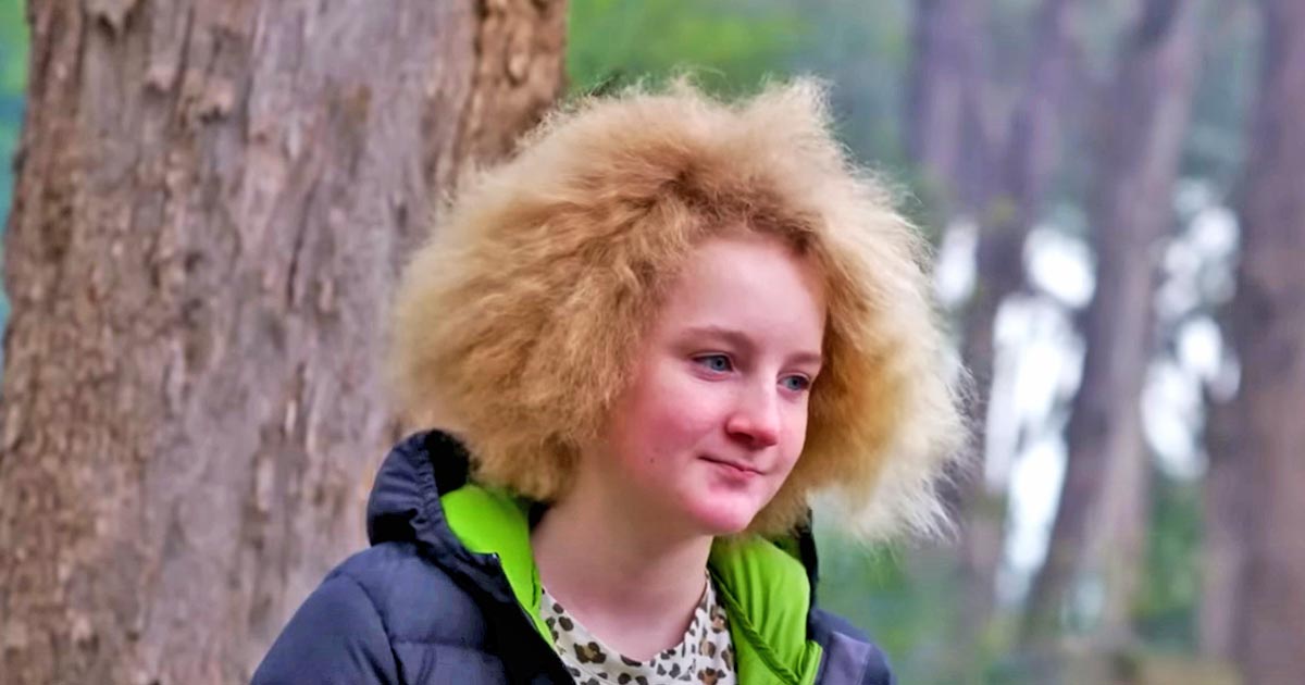 Young girl learns to love her uncombable hair syndrome