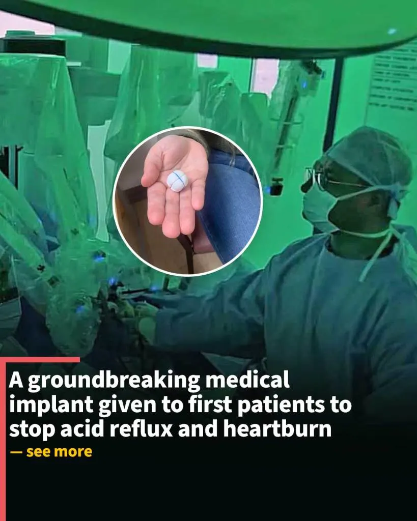 Stop Acid Reflux? New Implant Shows Promise in UK Trials